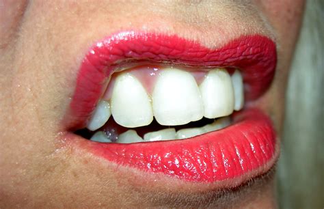 El Sexo Oral Provoca Cáncer ¿verdad O Mentira Sexperimentando
