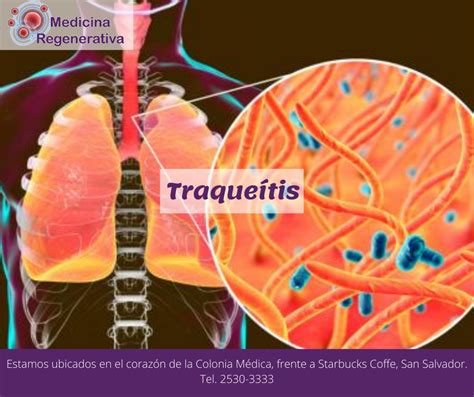 Instituto Internacional De Medicina Regenerativa Células Madre La Traqueítis Bacteriana Es