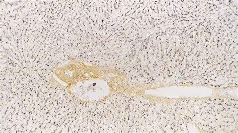 Human Cholangiole In Section Filmed Under Microscope 100x Against White