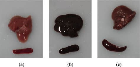 Liver And Spleen Morphology Of Pb In The Blank Group A Model Group