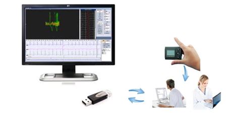 Holter Ecg Analysis Software Kamed International