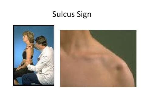 Kin 191 B Shoulder Injuries