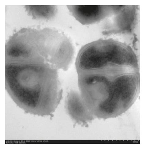A B Transmission Electron Micrographs Of Untreated Mrsa Cells