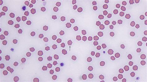 Bacteria Archives Eclinpath