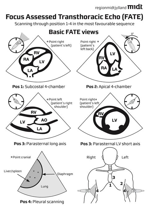 Echo Shock — Pocus Uk