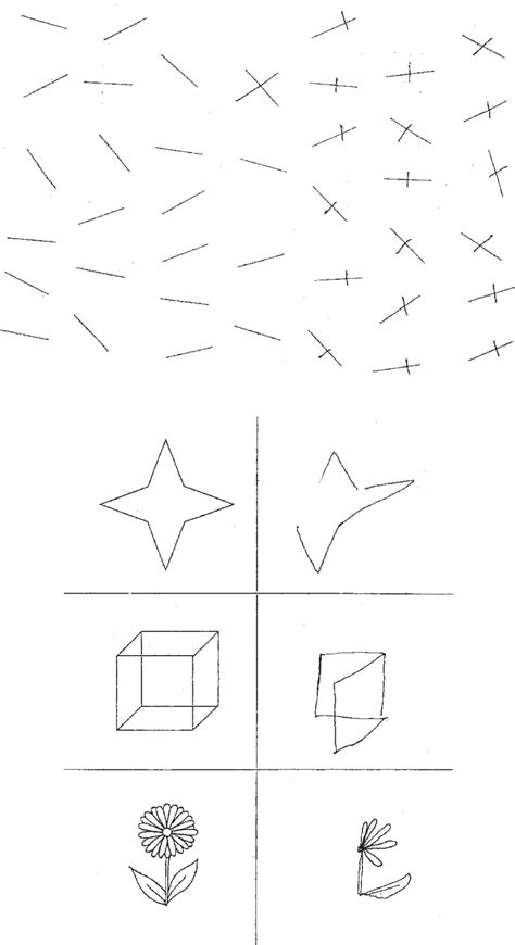 Performance Of A Patient With Spatial Neglect In Two Subtests Of The