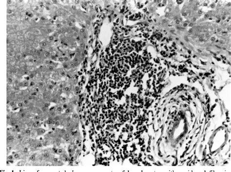 Figure 1 From Chronic Lymphocytic Cholangitis In Three Cats Semantic