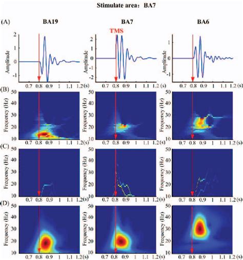 Figure 3 From Synchrosqueezing Algorithm Application In Tms Eeg