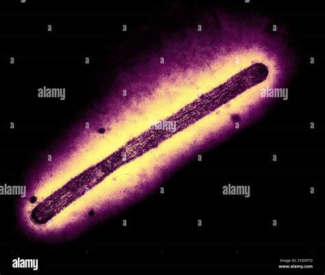 Transmission Electron Microscope Image Of An Influenza A H5n1 Bird Flu
