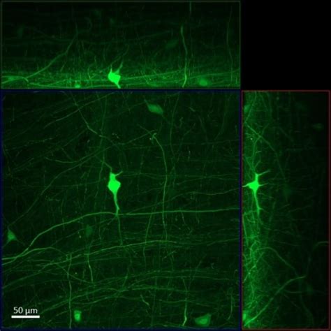 Multiphoton Microscope Zeiss Lsm 980 Non Linear Optics Strec