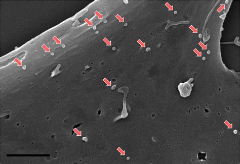 What Are Exosomes And Can They Be Used For Therapy The Niche