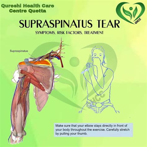 Supraspinatus Tear Exercises