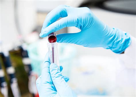 Hybrid Microscope X Zell