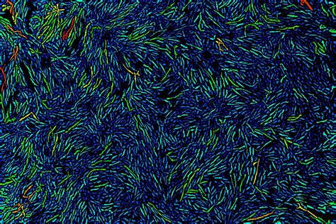 How Can I Calculate The Cell Conflict Rate Area Ratio Of Cells On The