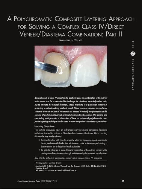 Class Iv Restorations Polychromatic Tooth Enamel Dental Composite