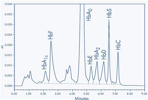 7 Schematic Representation Of Hb Variants Separation In Hplc