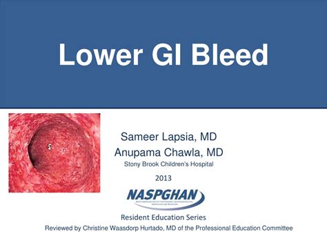 Ppt Lower Gi Bleed Powerpoint Presentation Free Download Id8847248