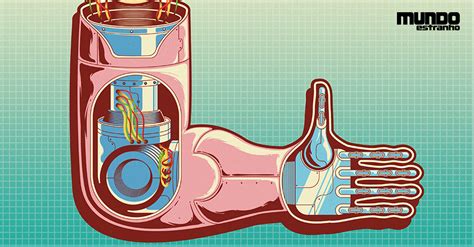 Como Uma Prótese é Instalada Super