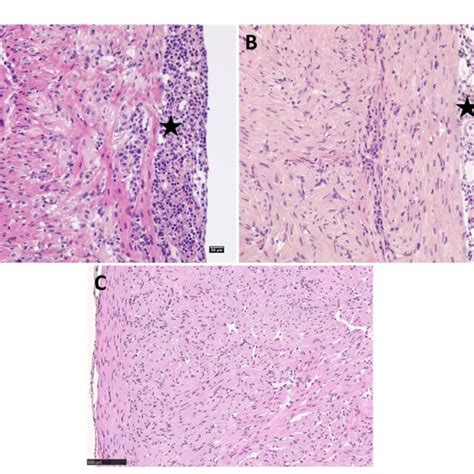 Prv 1 Challenged Atlantic Salmon Post Smolts Heart Ventricle Showing