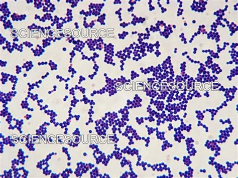 Staphylococcus Aureus Under A Microsco Stock Image Science Source