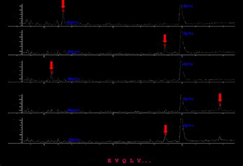 Example Of Edman N Terminal Sequencing Of Aβ Autoantibody Heavy Chain