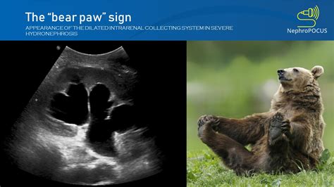 Bear Paw Nephropocus