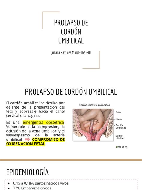 Prolapso De Cordon Umbilical Pdf Parto Reanimación Cardiopulmonar