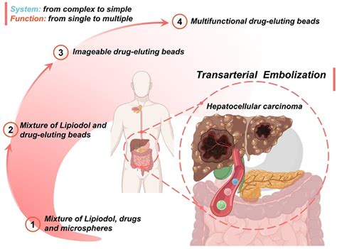 Bench To Bedside Development Of Multifunctional Flexible Embolic Agents