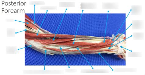 Posterior Forearm Cadaver Diagram Quizlet