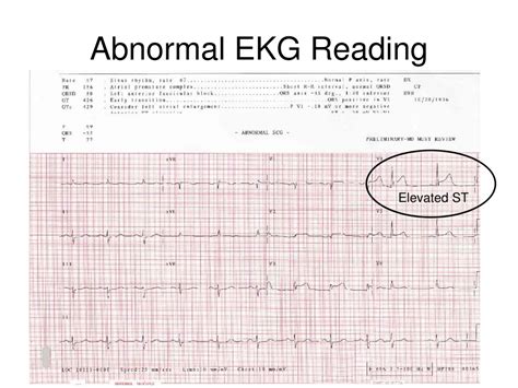 Ppt Ekg Lab Proper Ekg Setup And Lead Placement Powerpoint Presentation Id 9688809