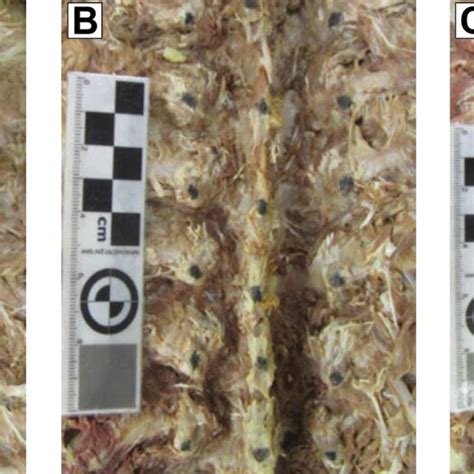 Example Photographs Of The Thoracic Regions Of A Cadaver To Measure The Download Scientific