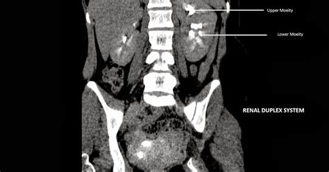Ultimate Radiology Renal Duplex Systems