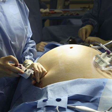 Preoperative Atelectasis And Its Impact On Oxygen Saturation In Obese