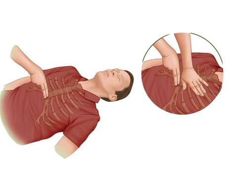 Xiphoid Process First Aid Glossary