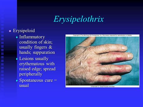 The Gram Positive Bacilli Of Medical Importance Ppt Video Online Download