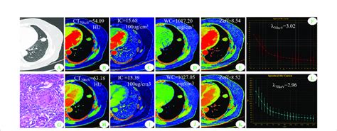 Dual Energy Spectral Ct Images And Pathological Sections Of A