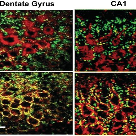 Internalization Of Synaptic Gaba‐a Receptors During Se β2β3 Subunits