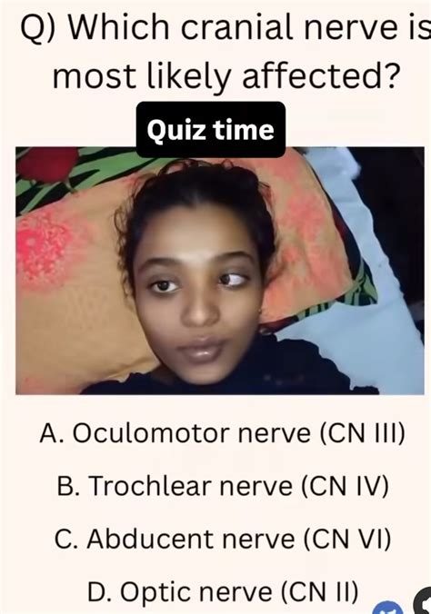 Understanding Prentices Rule And Its Calculation An Eye Care Blog