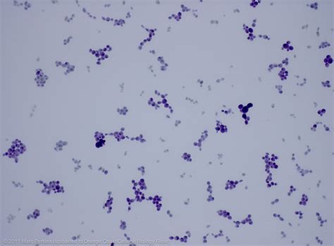 Yeast ~400x Stained Yeast On A Slide Unknown Species Marc Perkins