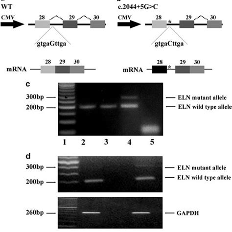 Schematic Representation Of The Eln Mutations Identified In This Study