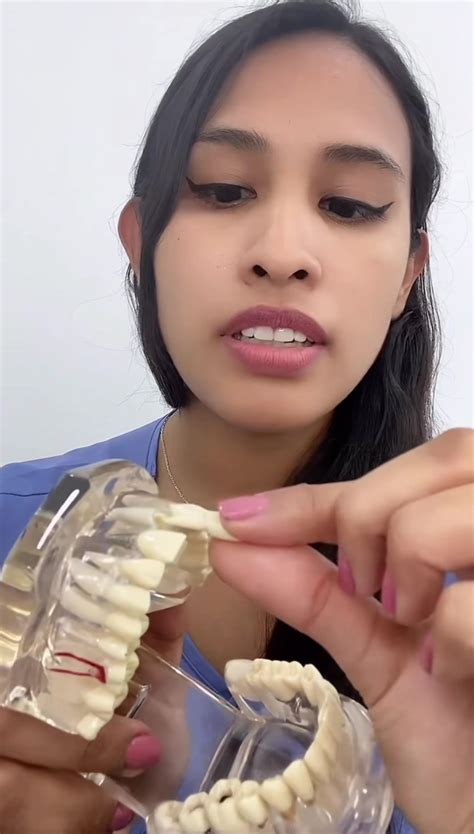 ¿sabes Cuál Es La Diferencia Entre Un Implante Dental Y Un Poste O