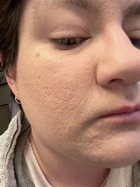 Why Does My Foundation Look Like Its Sitting On Top Of My Skin At