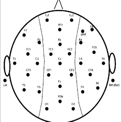 Electrode Configuration Download Scientific Diagram