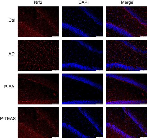 Activated Keap1 Nrf2 Signaling Pathway Immunofluorescence If × 20