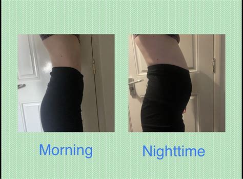 Ablation Vs Excision Graphic Not Sure If This Has Been Shared Here