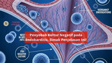 Penyebab Kultur Negatif Pada Endokarditis Simak Penjelasan Ini