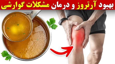 چرا این خوراکی برای مشکلات روده ای و آرتروز معجزه می کند Youtube