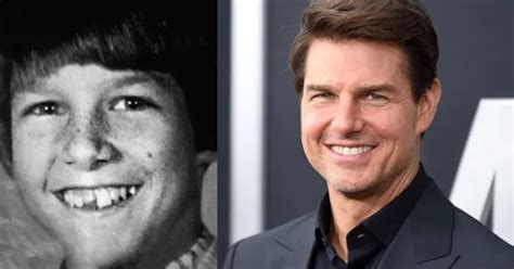 Tom Cruises Teeth Tom Cruises Iconic Hollywood Smile