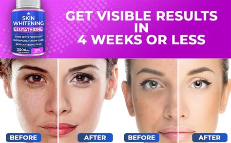 Glutathione Before And After Celebrity 60 Photos Moonagedaydreamfilm