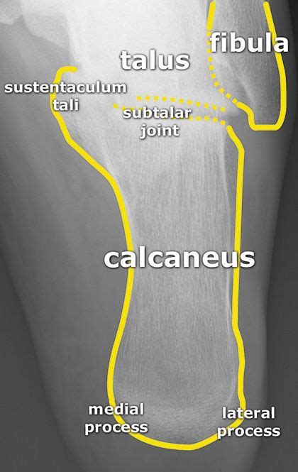 X Enkel Startradiology Medical Radiography Radiology Imaging